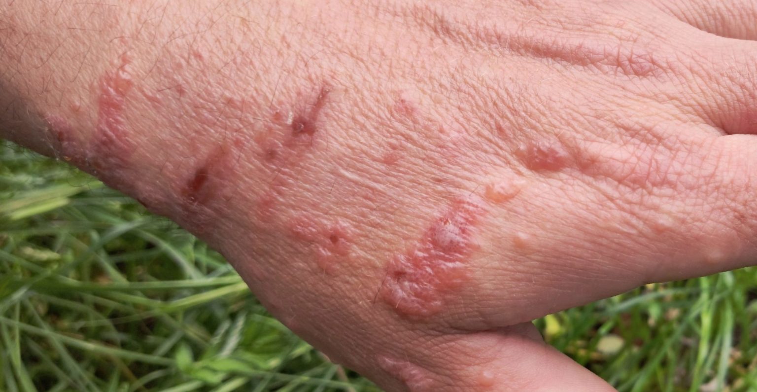 23 Types of WHITE Wildflowers in Ontario! (2025) - Bird Watching HQ